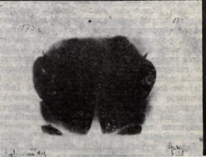 Records of Carl Clauberg’s criminal experiments - Medical Review ...