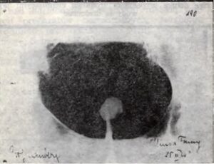 Records of Carl Clauberg’s criminal experiments - Medical Review ...